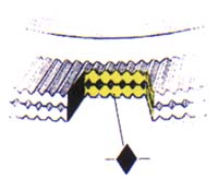 Disc Filteration System
